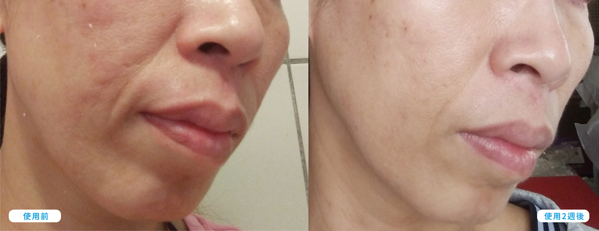 Simplism簡單保養玻尿酸B3精華前測報告 - Simplism簡單保養