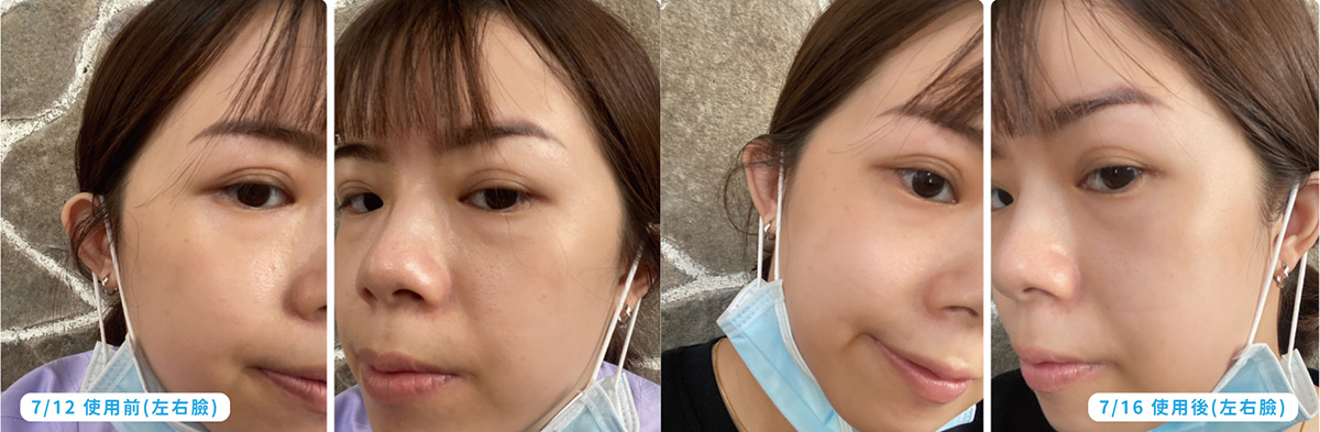 Simplism簡單保養玻尿酸B3精華前測報告 - Simplism簡單保養